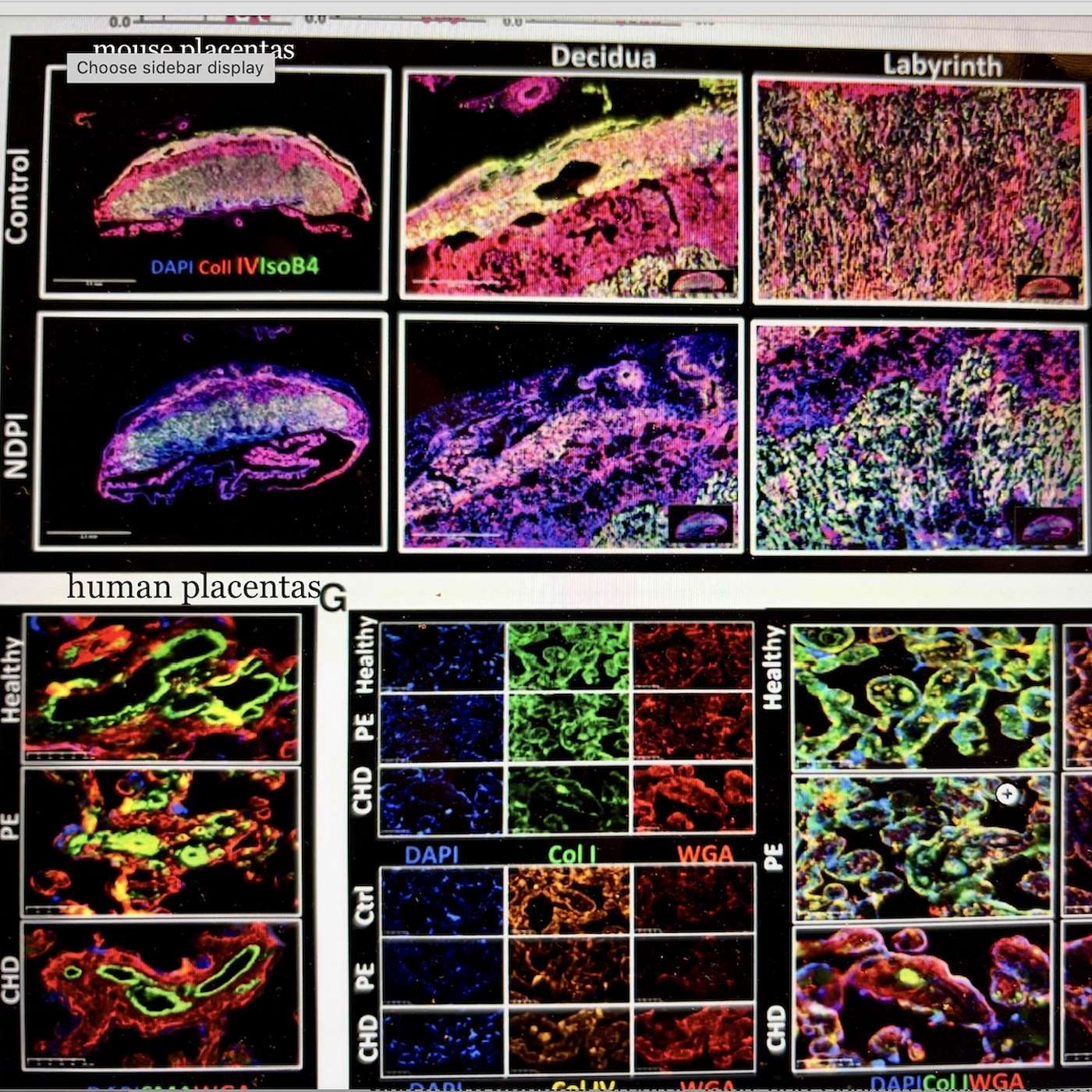 How we might manage early immune cell trouble in the placenta ...