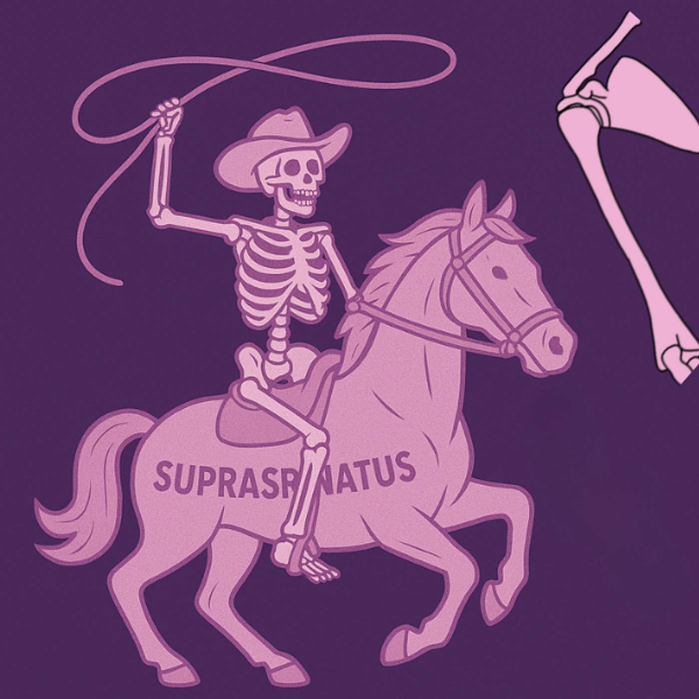 Repair vs. Reverse: The Progression of Rotator Cuff Pathology - Listen ...