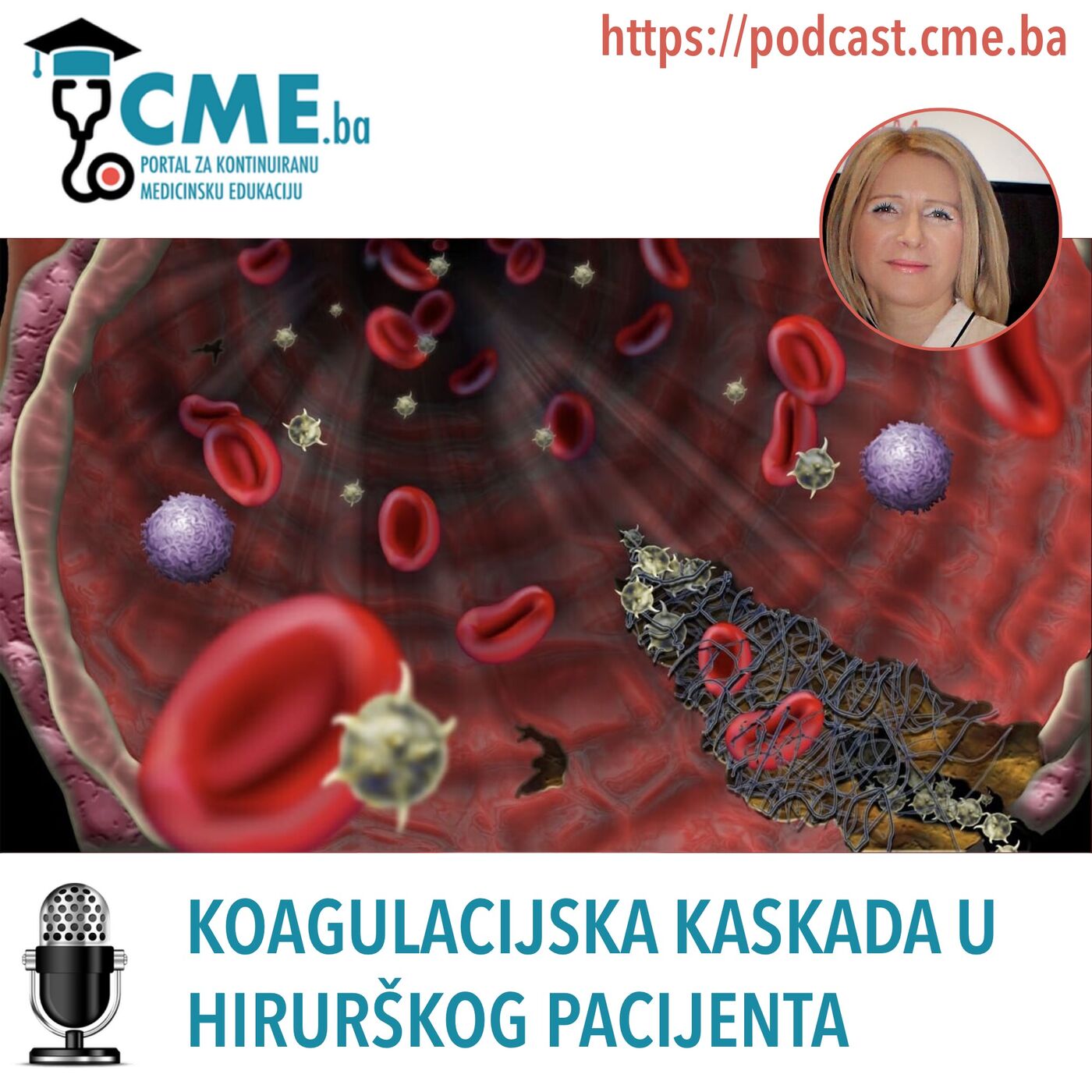 Koagulacijska kaskada u hirurškog pacijenta – CME.ba